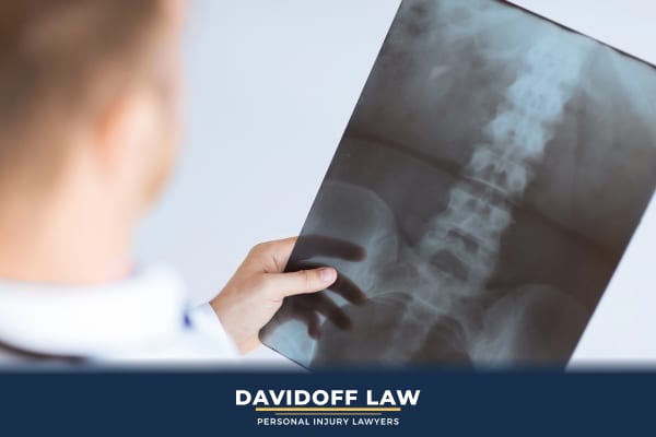 Top Queens Car Accident Pinched Nerve Lawyer for Your Injury Claim